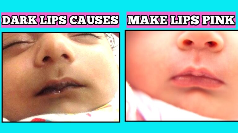 8 Common Causes of Dark Lips in Babies: How to Make Baby Lips Pink ...