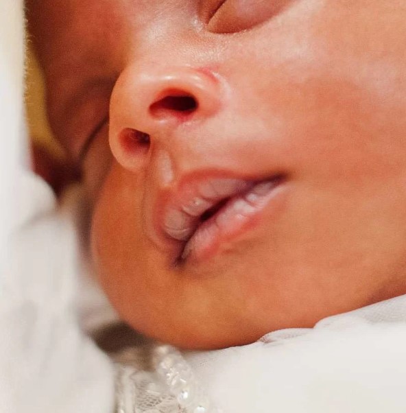 8 Common Causes of Dark Lips in Babies: How to Make Baby Lips Pink ...